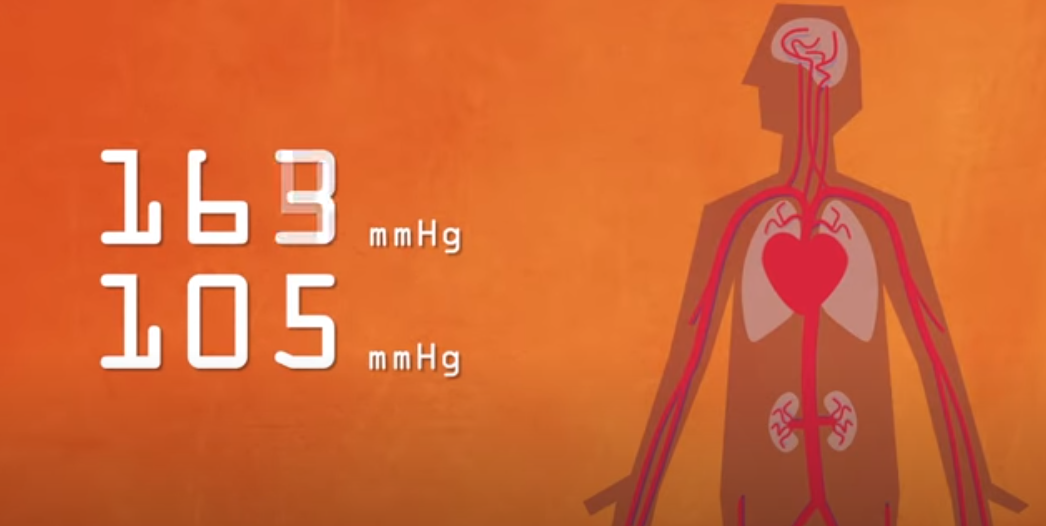 Hypertension Awareness Month: Shining a Light on Hypertension